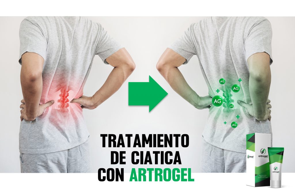 Artrogel Ciatica - Artrogel